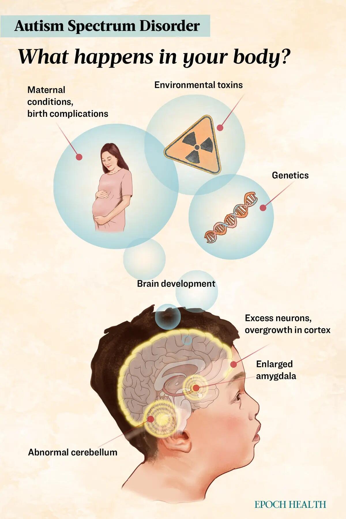 Autism Spectrum Disorder: Symptoms, Causes, Treatments, And Natural ...