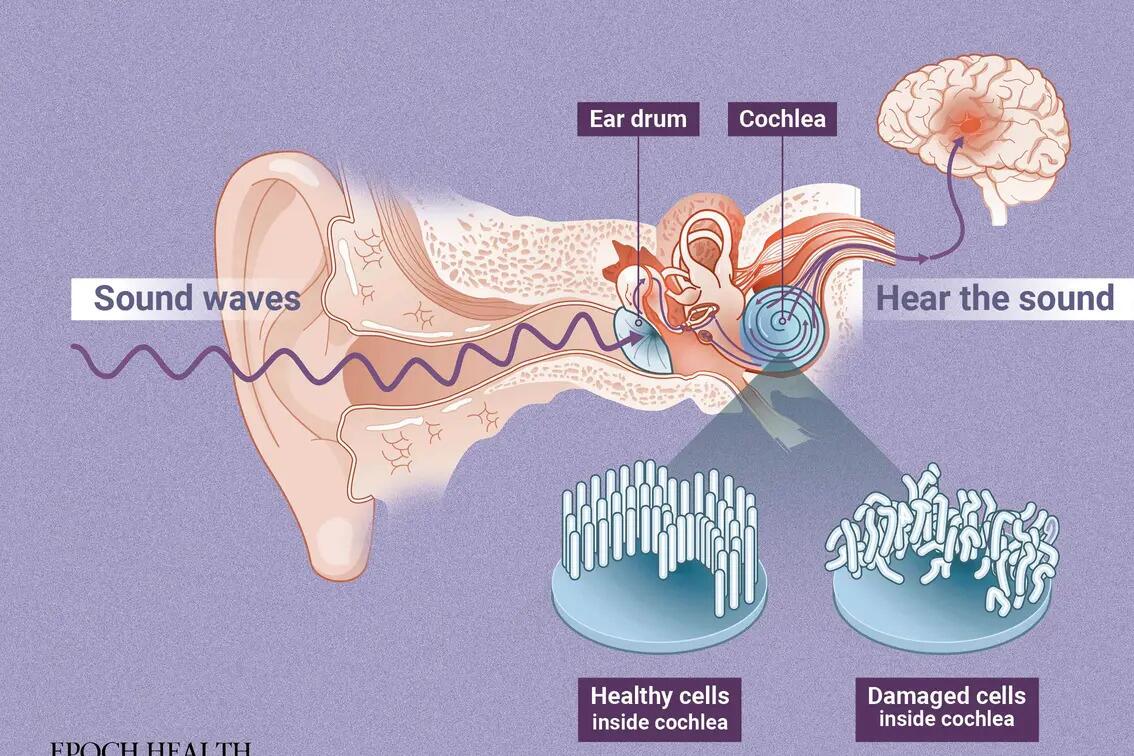 Long-Wear, Noise-Cancelling, And Wireless: How Earphones Damage Our ...