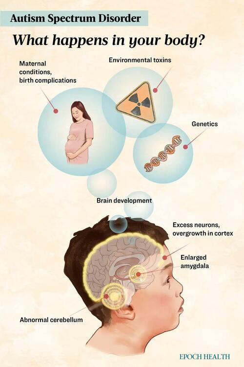 Autism Spectrum Disorder: Symptoms, Causes, Treatments, And Natural ...