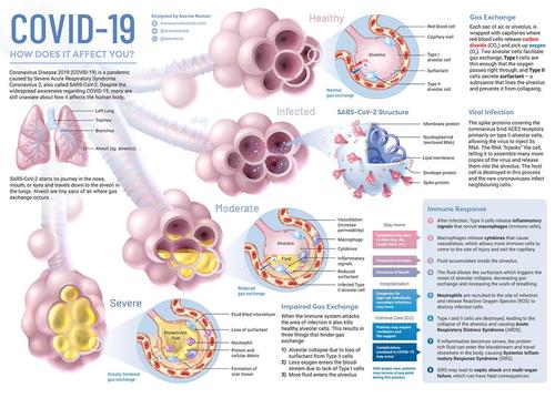 Visualizing What COVID-19 Does To Your Body | ZeroHedge Visualizing What COVID-19 Does To Your Body | ZeroHedge
